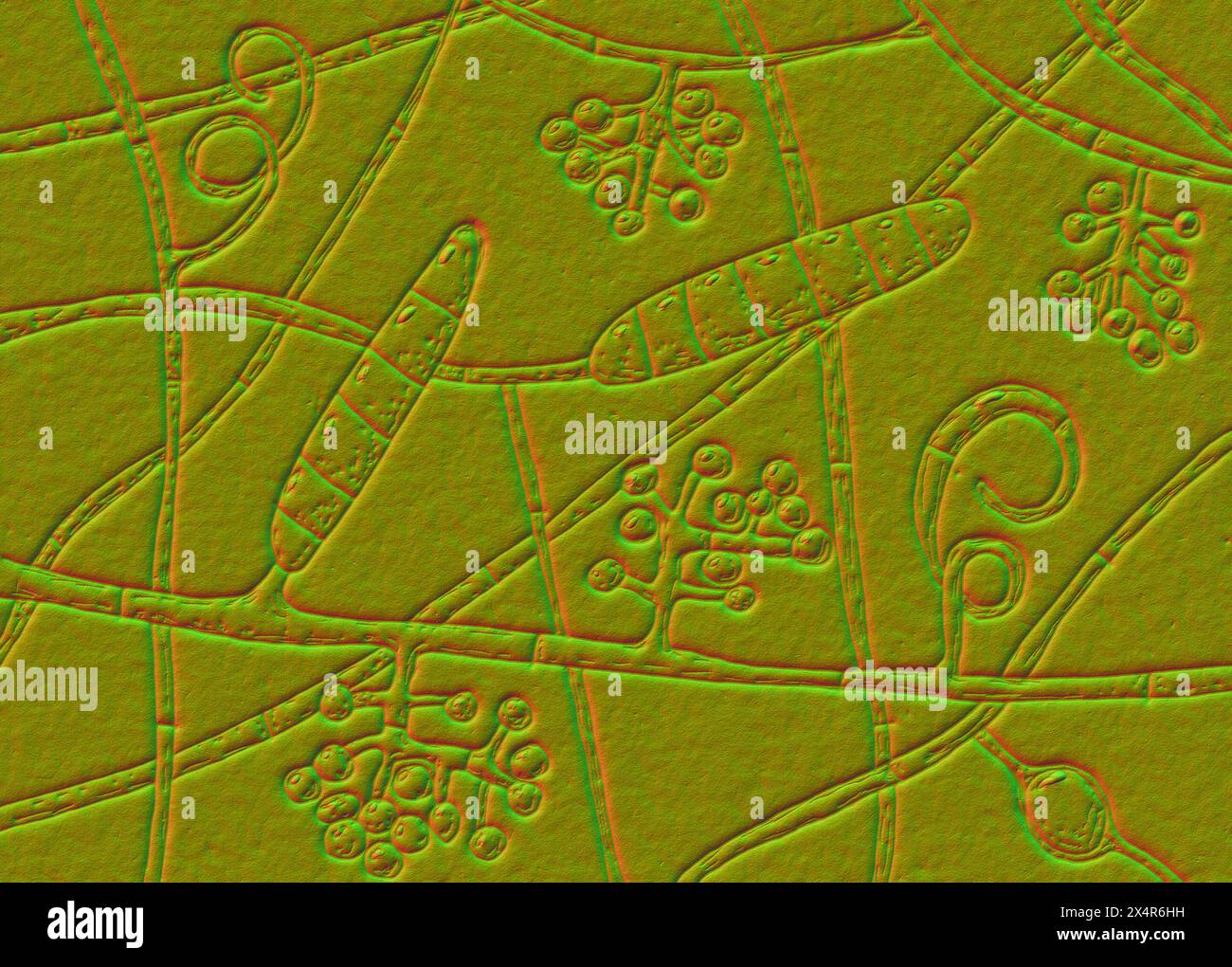 Illustration of Trichophyton mentagrophytes fungi, showing macroconidia ...