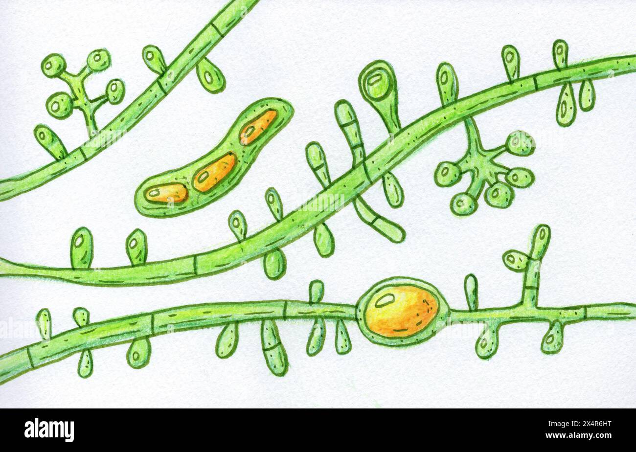 Illustration of Trichophyton tonsurans fungi. This dermatophyte fungus ...