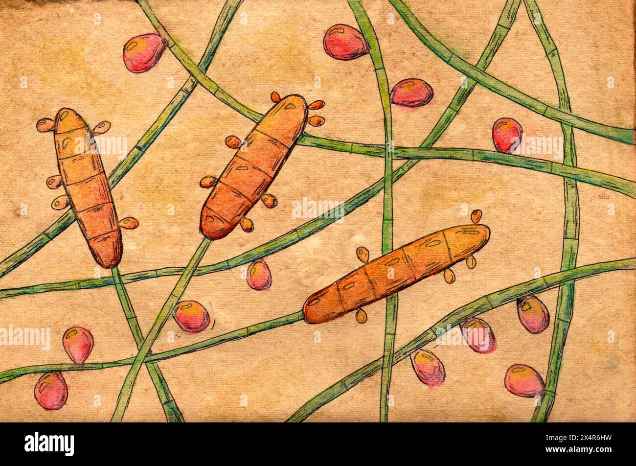 Illustration Of Trichophyton Rubrum Fungi Showing Macroconidium Microconidia And Septate