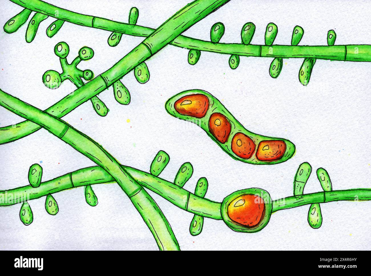 Illustration of Trichophyton tonsurans fungi. This dermatophyte fungus ...