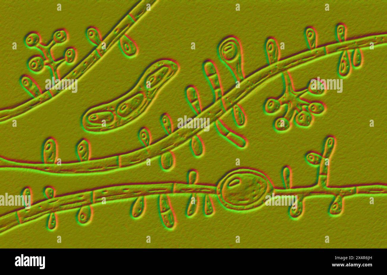 Illustration of Trichophyton tonsurans fungi. This dermatophyte fungus ...