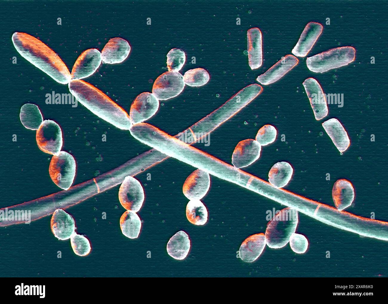 Trichosporon hi-res stock photography and images - Alamy