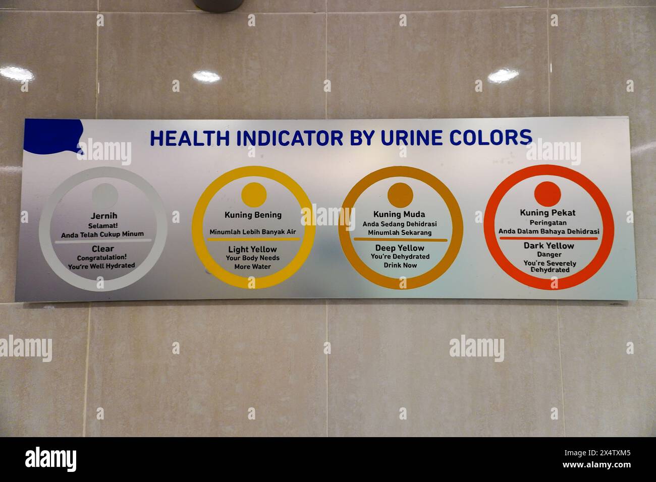 Health monitoring: Urine color-based indicator boards installed in ...