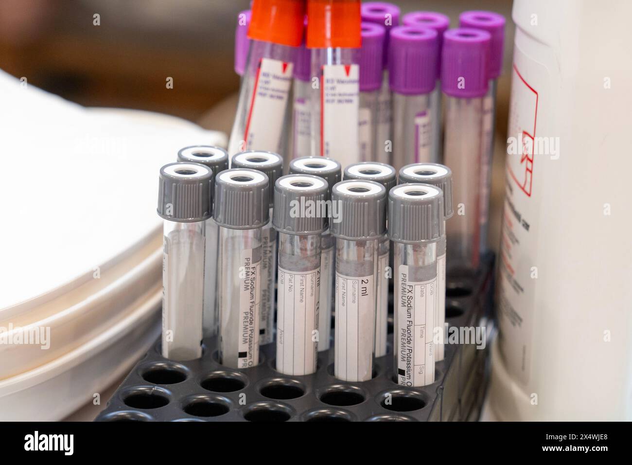 Blood sample tubes at a blood donation Stock Photo - Alamy