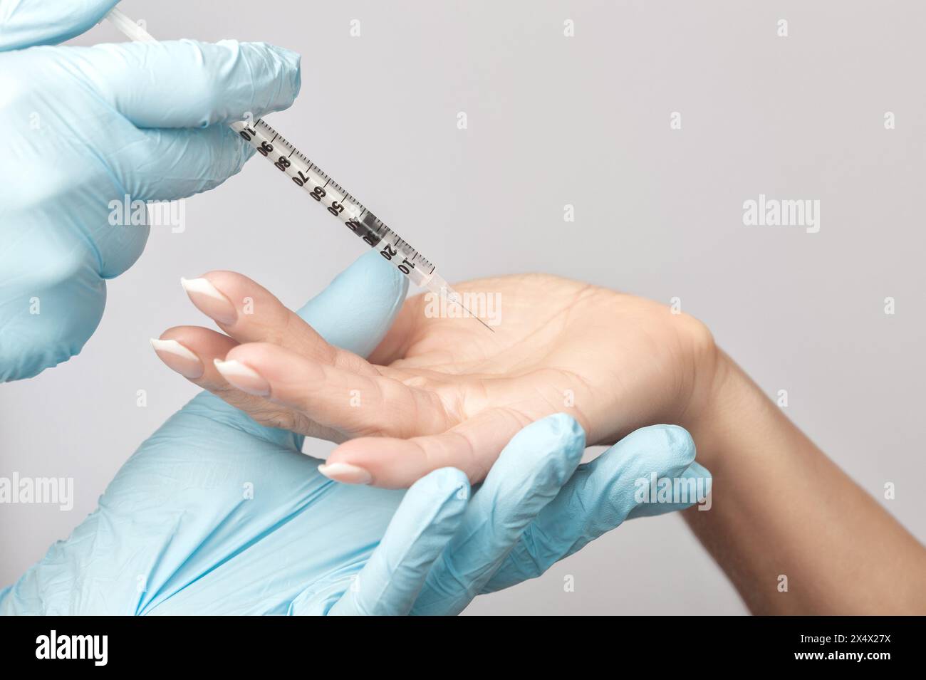 The doctor makes injections of botulinum toxin on the palms of a woman ...