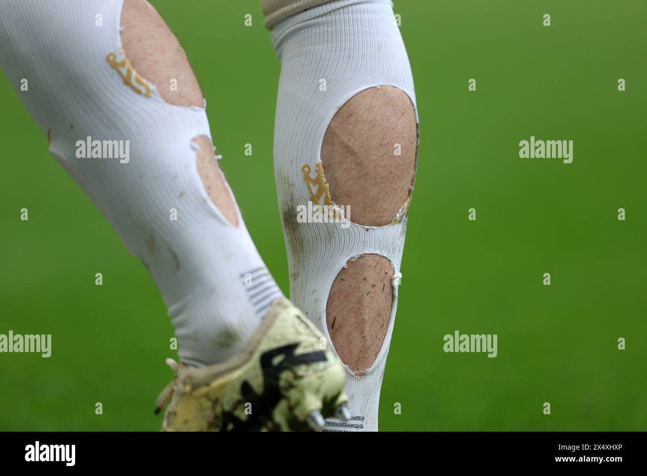 Calf muscles hi-res stock photography and images - Alamy