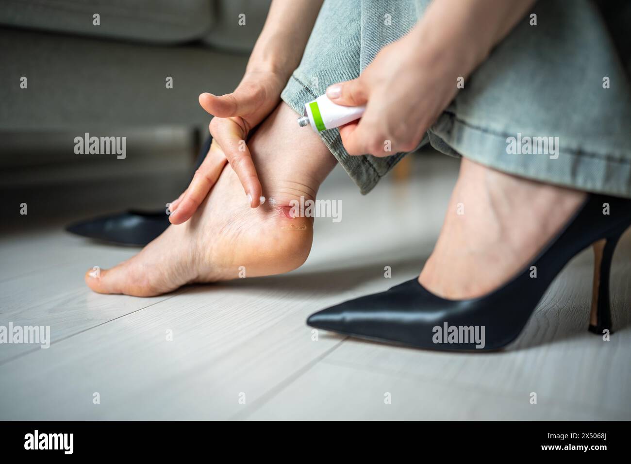 Skin soreness hi-res stock photography and images - Alamy