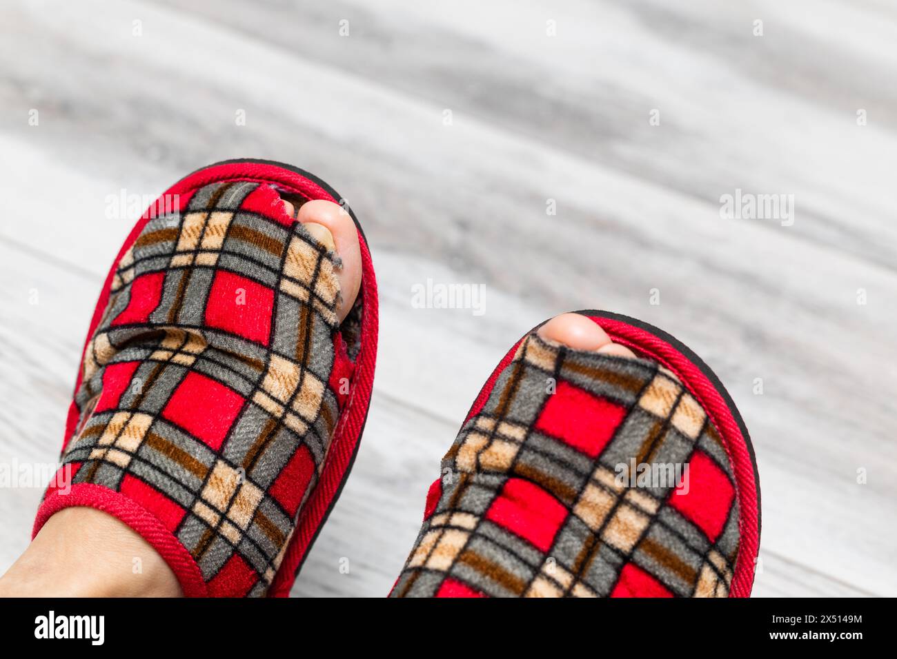 foot shod in an old leaky slipper. old slipper. holey sneaker. the toe ...