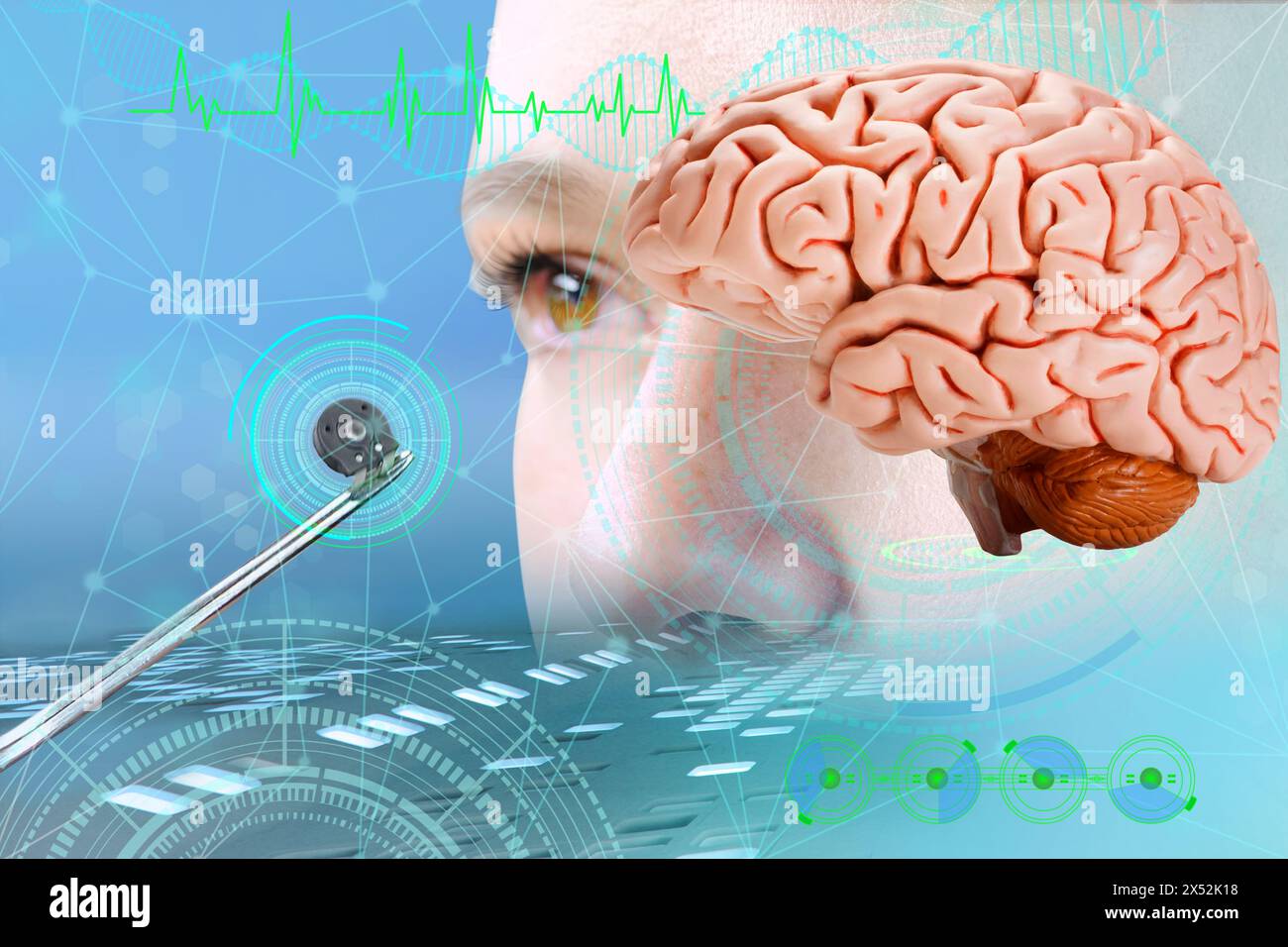 Electronic chip, bug in scientist's hand, Successful implantation of ...