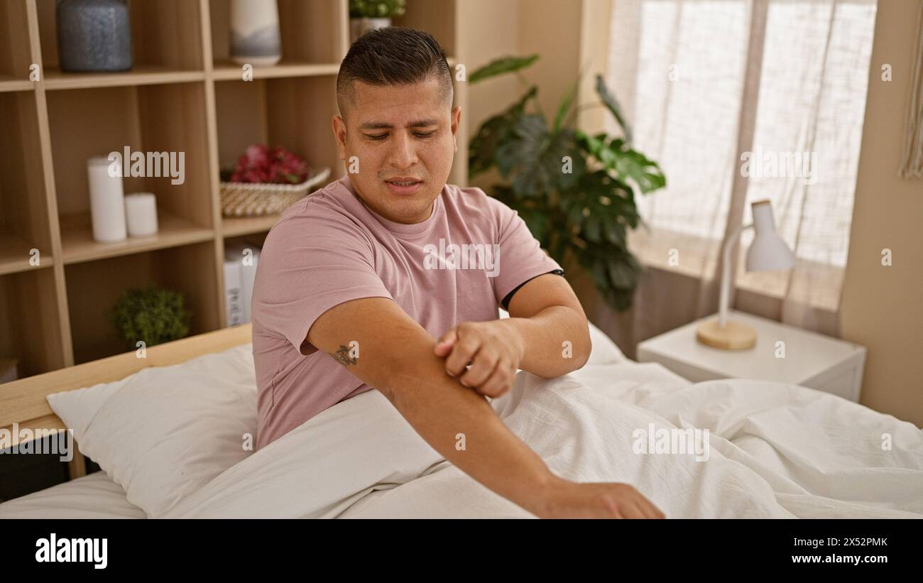 Handsome young latin man in pain, scratching itchy rash on arm while ...