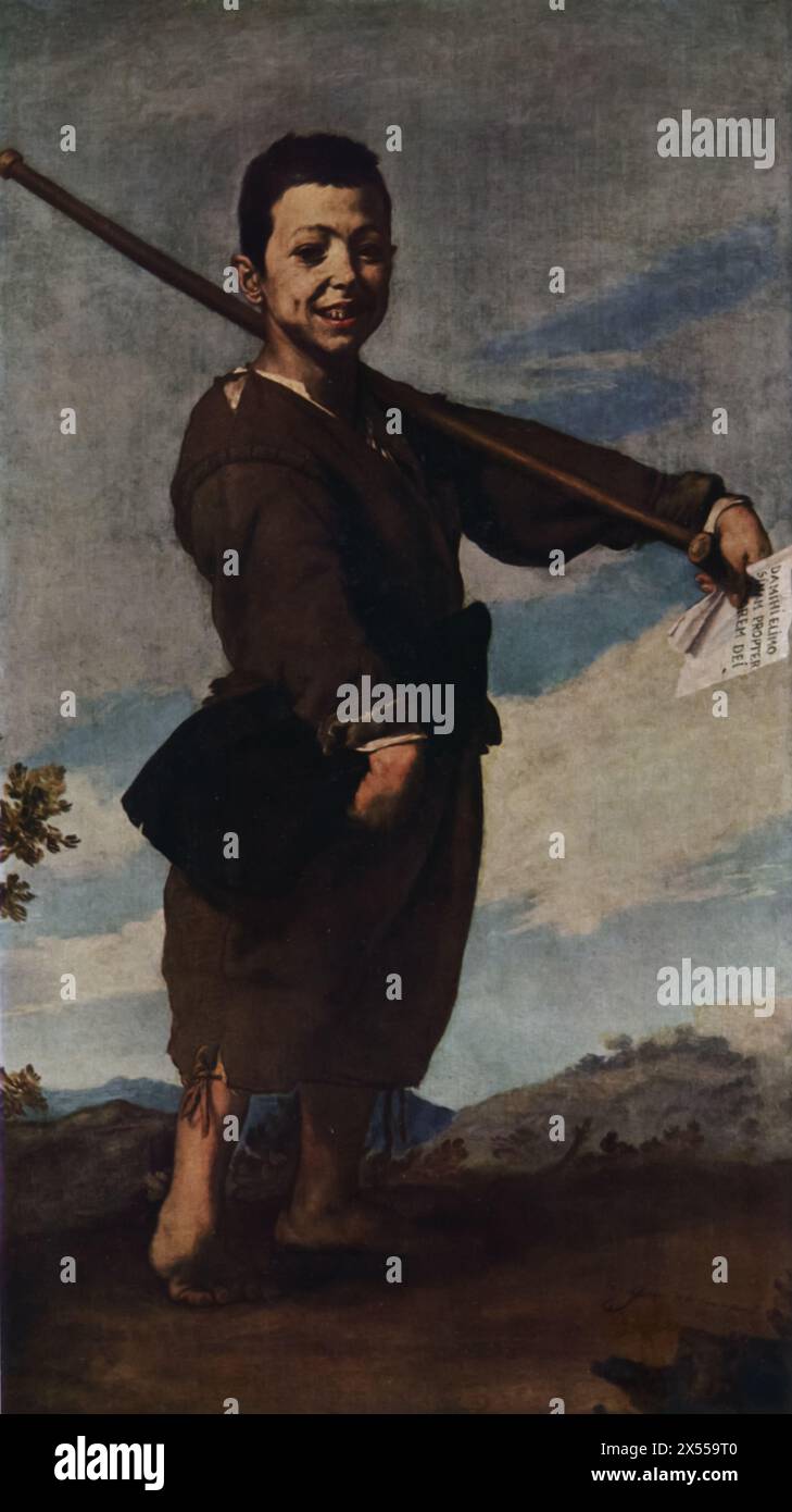 Clubfoot hi-res stock photography and images - Alamy