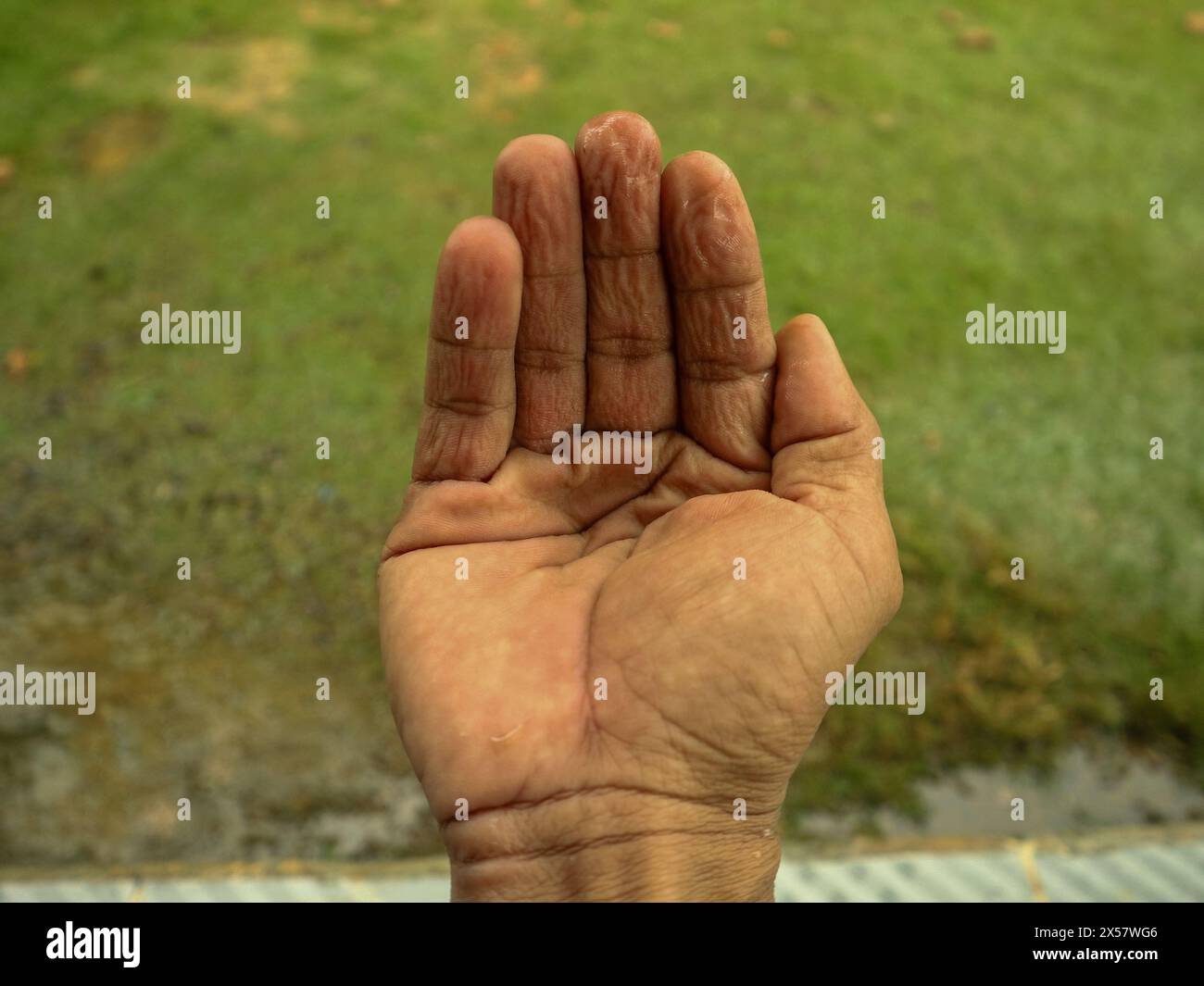 Wrinkled hands exposed to cold water for too long Stock Photo - Alamy