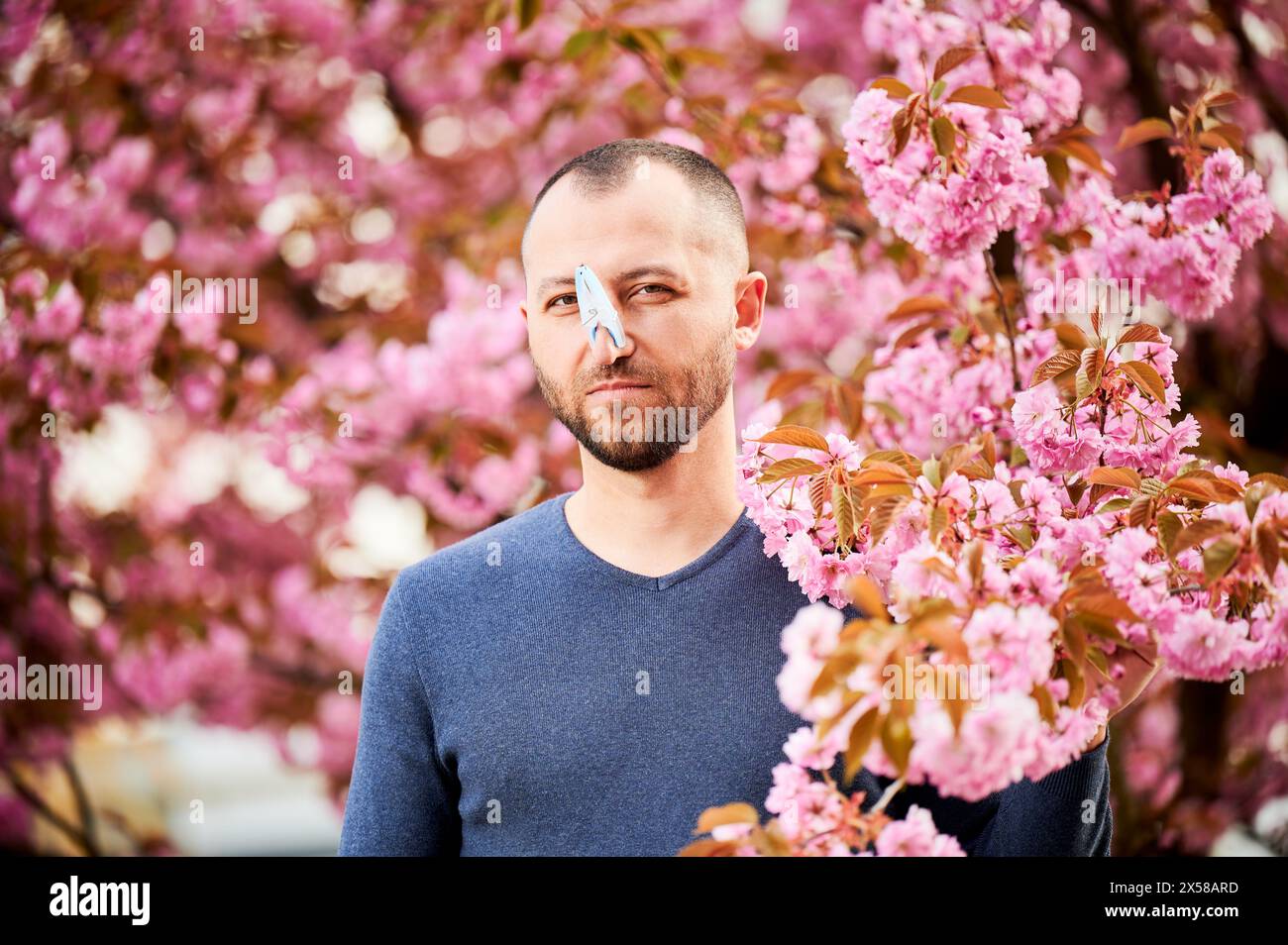 Man allergic suffering from seasonal allergy at spring. Bearded man ...