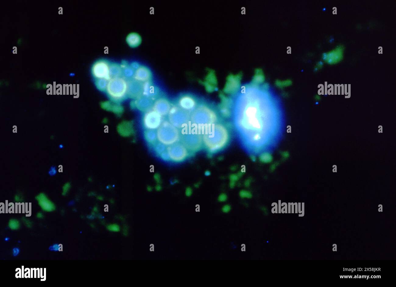 Light micrograph of the fungus Cryptococcus neoformans (blue) in a ...