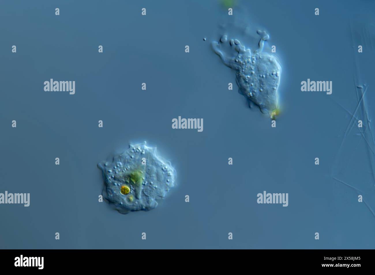 Differential interference contrast (DIC) light micrograph of ...