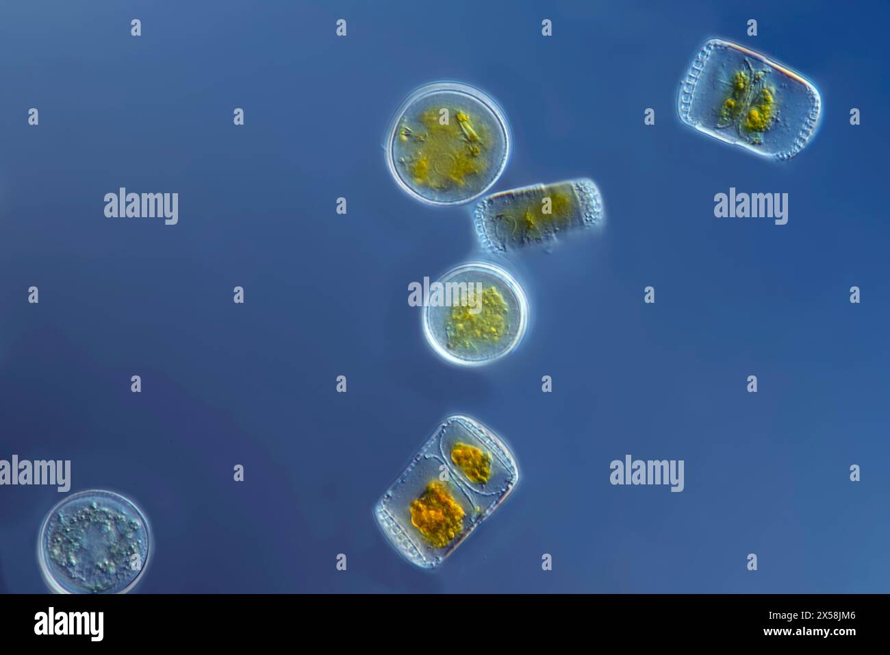 Differential interference contrast (DIC) light micrograph of ...