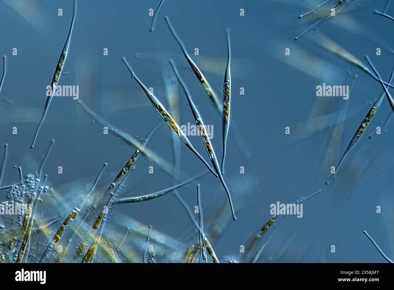 Differential interference contrast (DIC) light micrograph of ...
