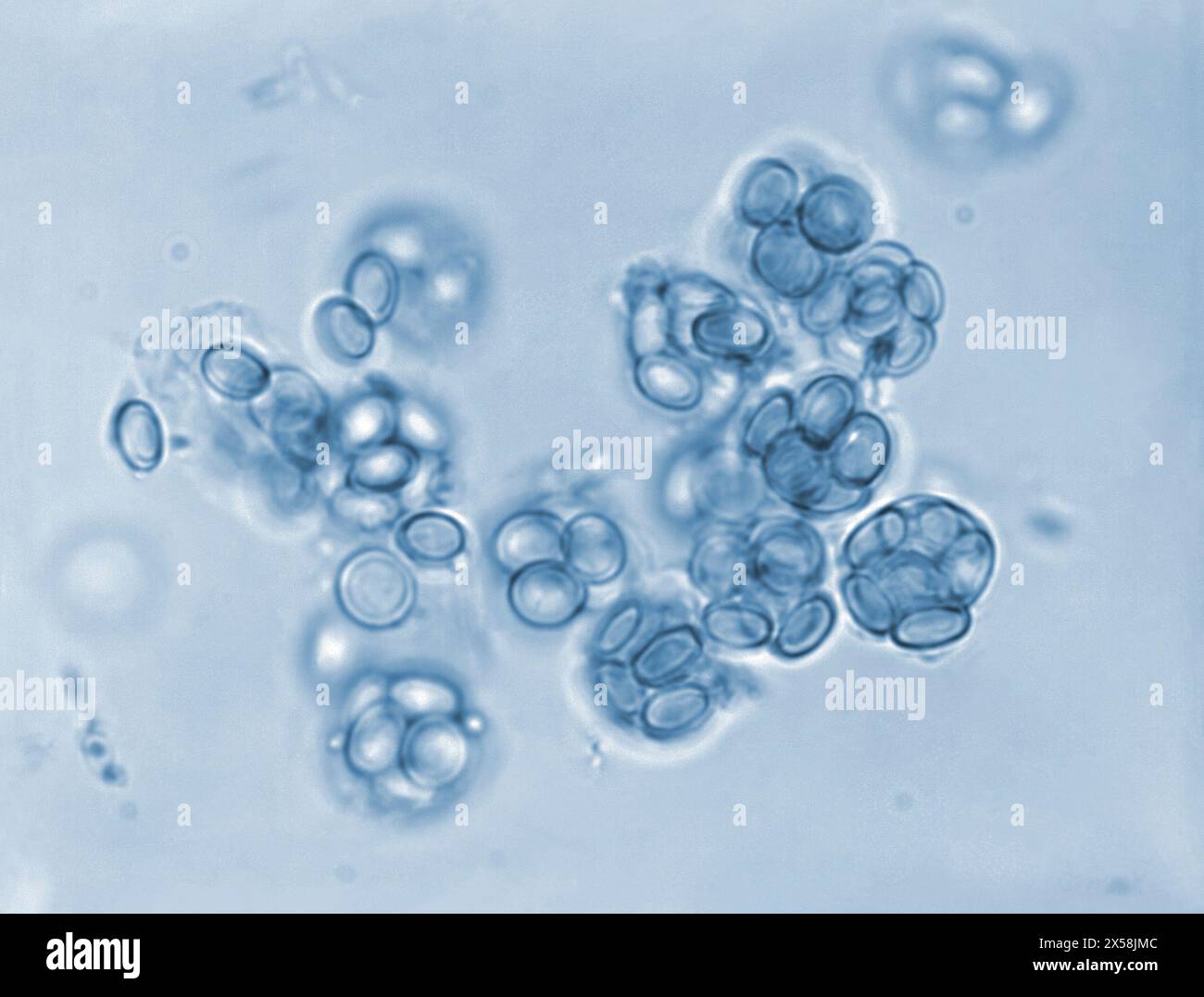 Light micrograph showing ascospores (reproductive units) of the fungus ...