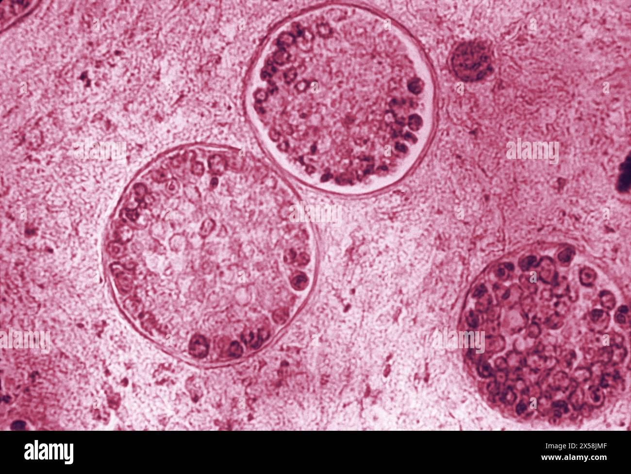 Stained light micrograph of Coccidioides immitis spherules, structures ...