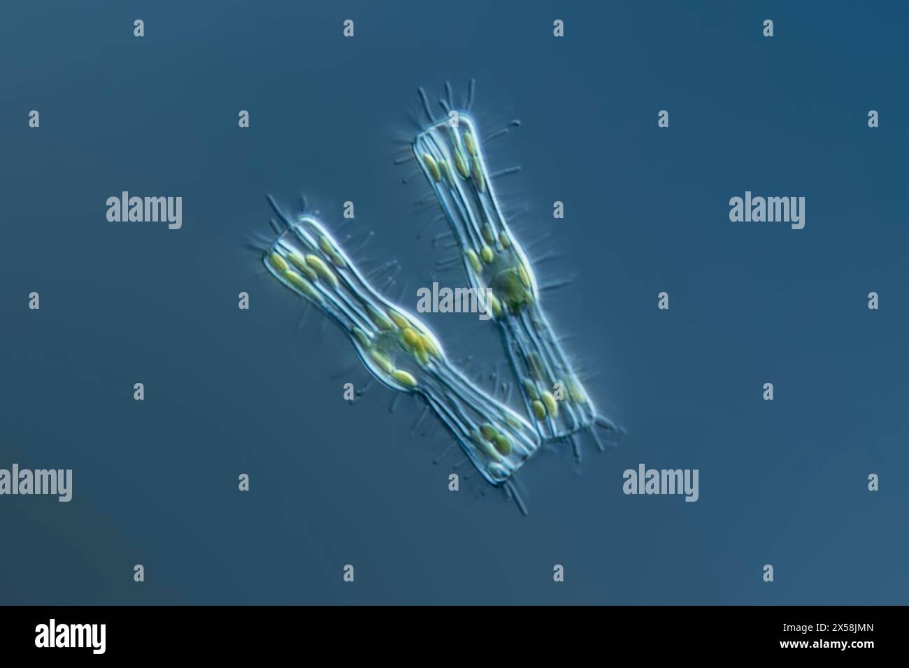 Differential interference contrast (DIC) light micrograph of ...