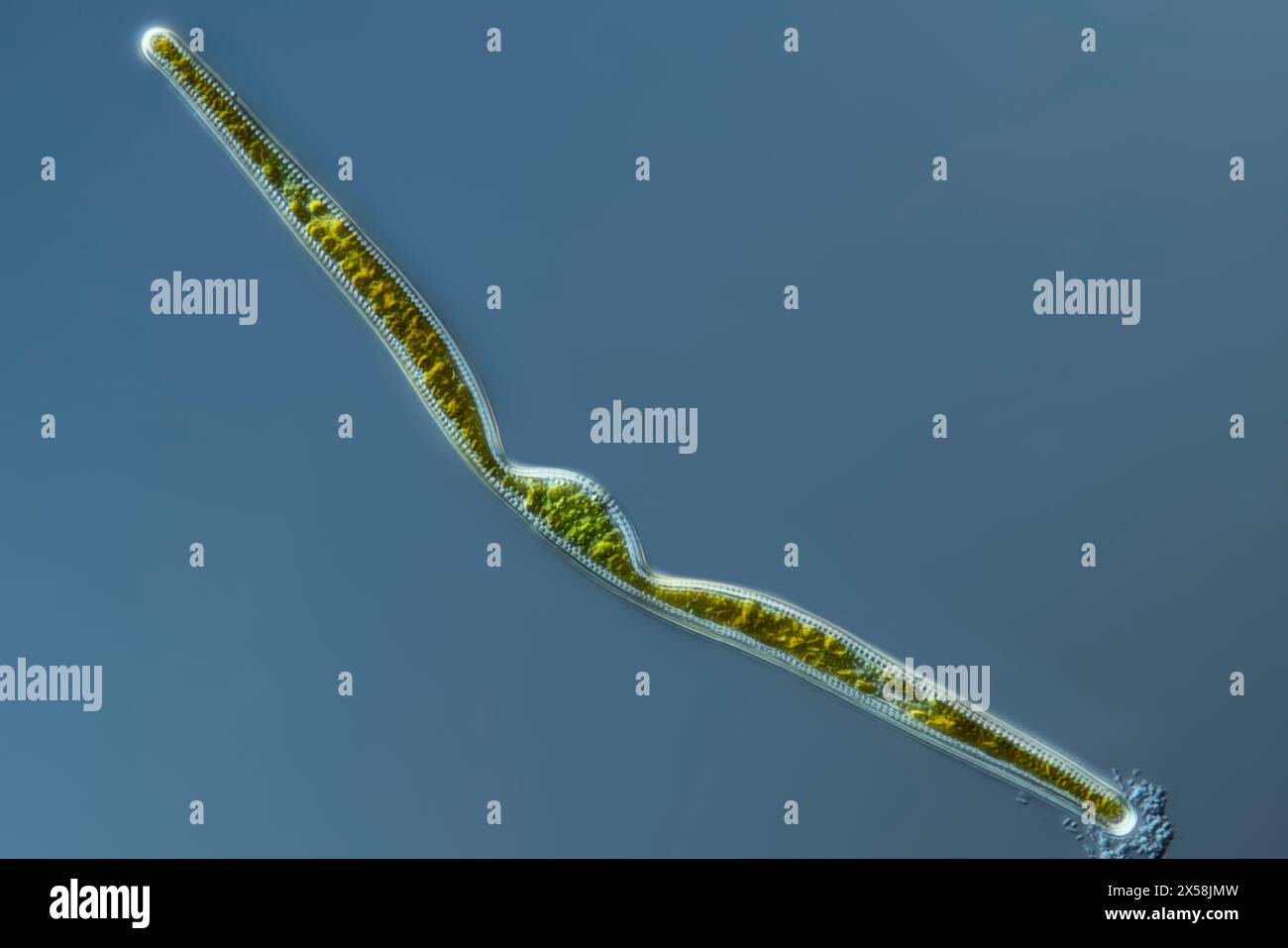 Differential interference contrast (DIC) light micrograph of Toxarium ...