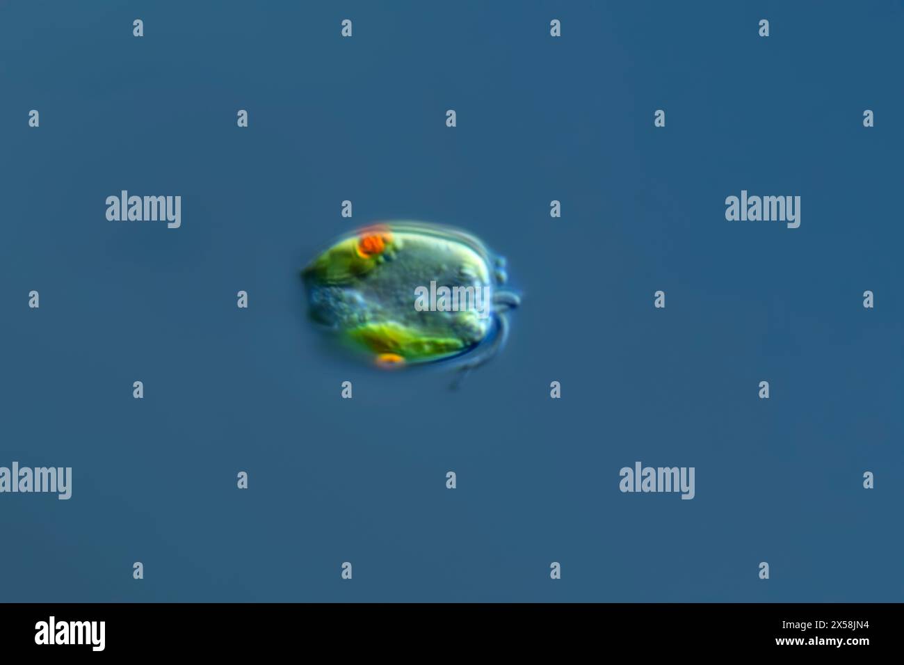 Differential interference contrast (DIC) light micrograph of ...