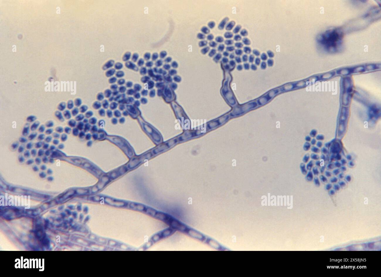 Light micrograph of the fungus Phialophora verrucosa. The small circles are spores, the ...