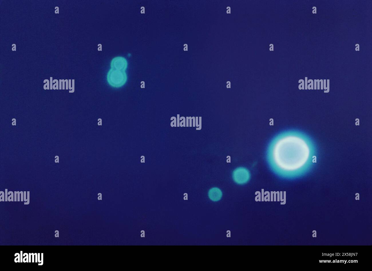Light micrograph of the yeast fungus Cryptococcus neoformans (blue ...