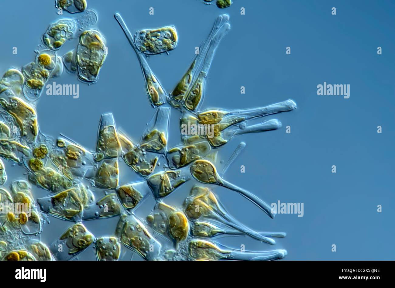 Differential interference contrast (DIC) light micrograph of ...