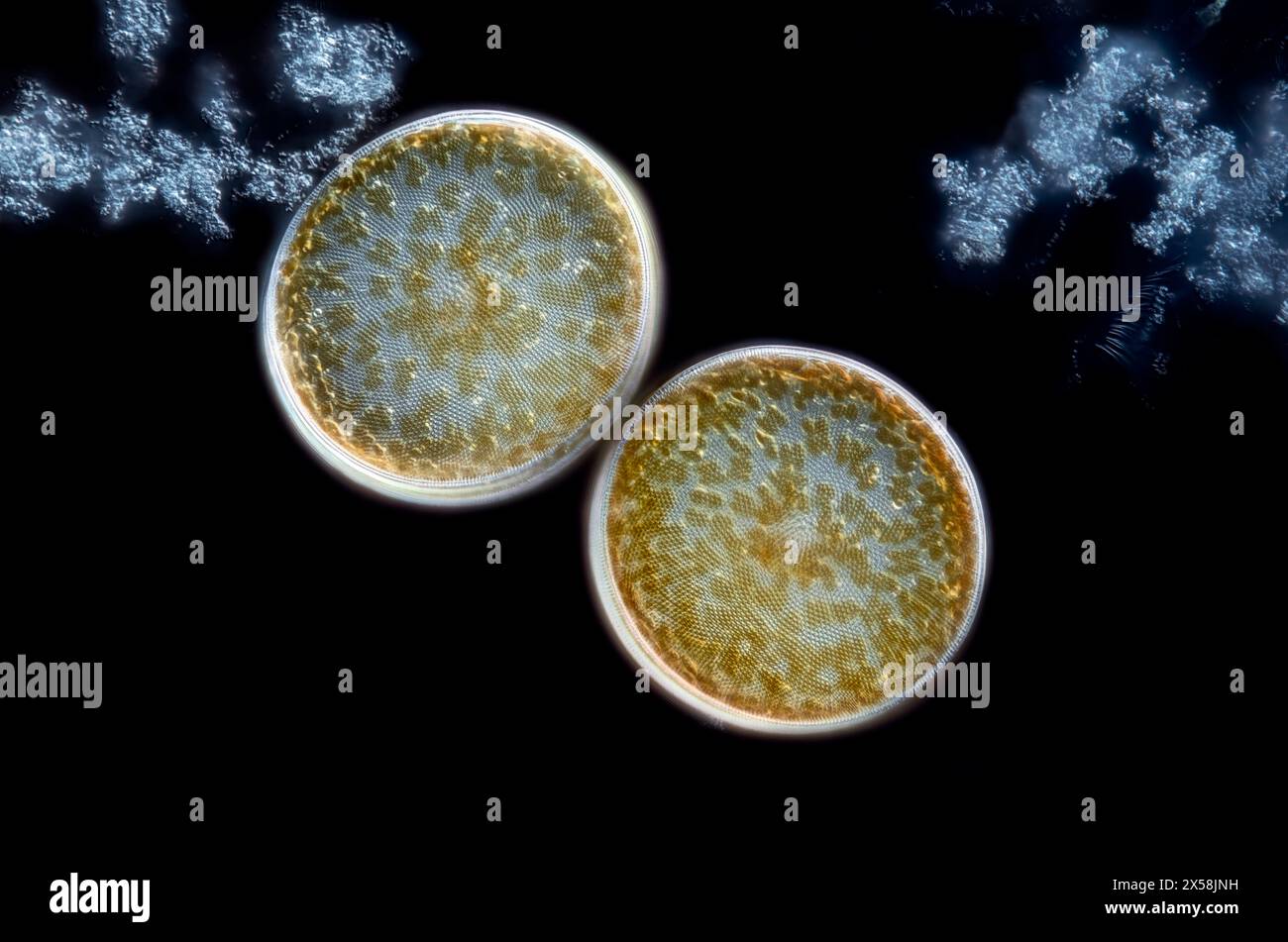 Differential interference contrast (DIC) light micrograph of ...