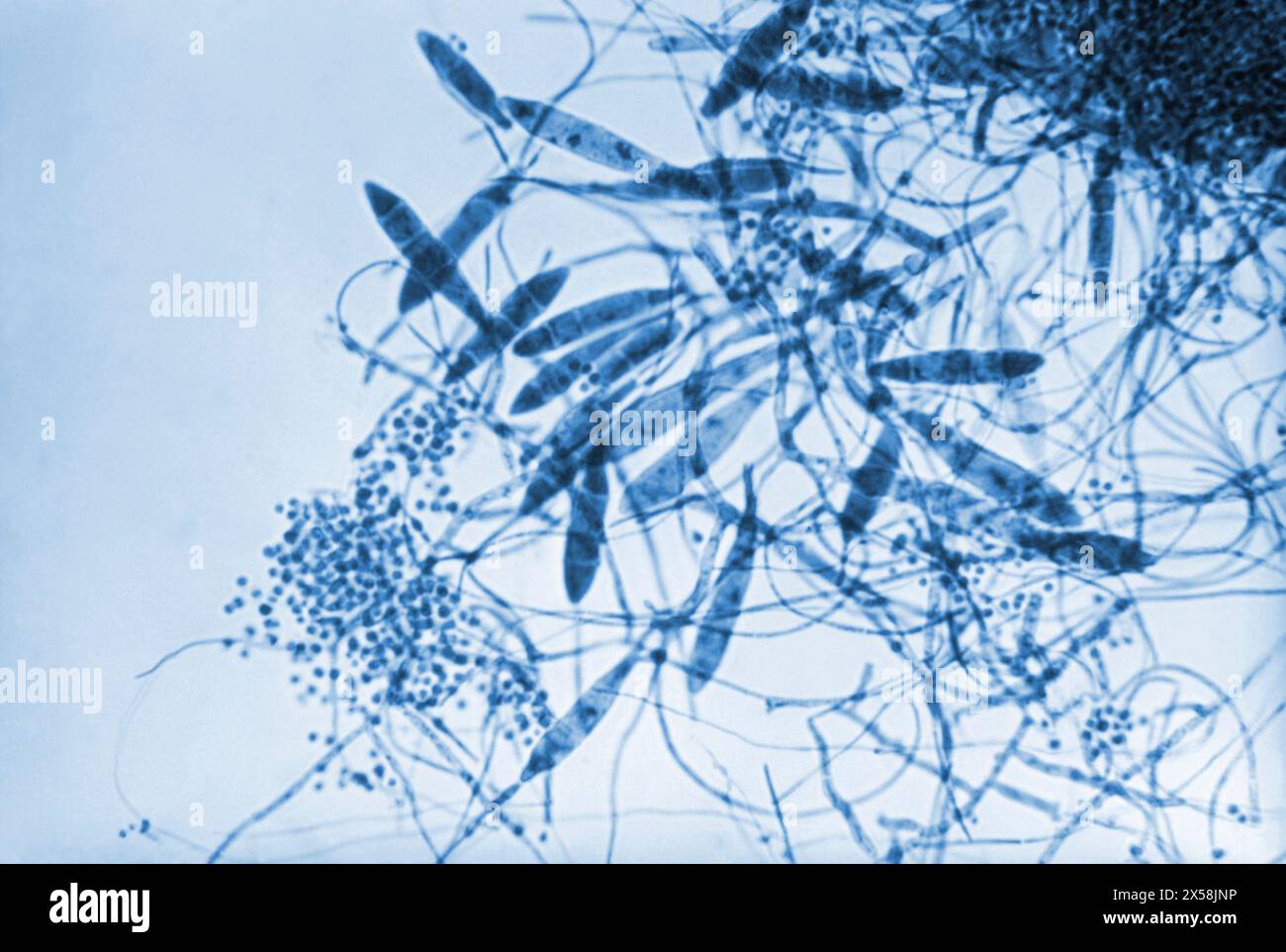 Light micrograph showing structures of the fungus Trichophyton ...