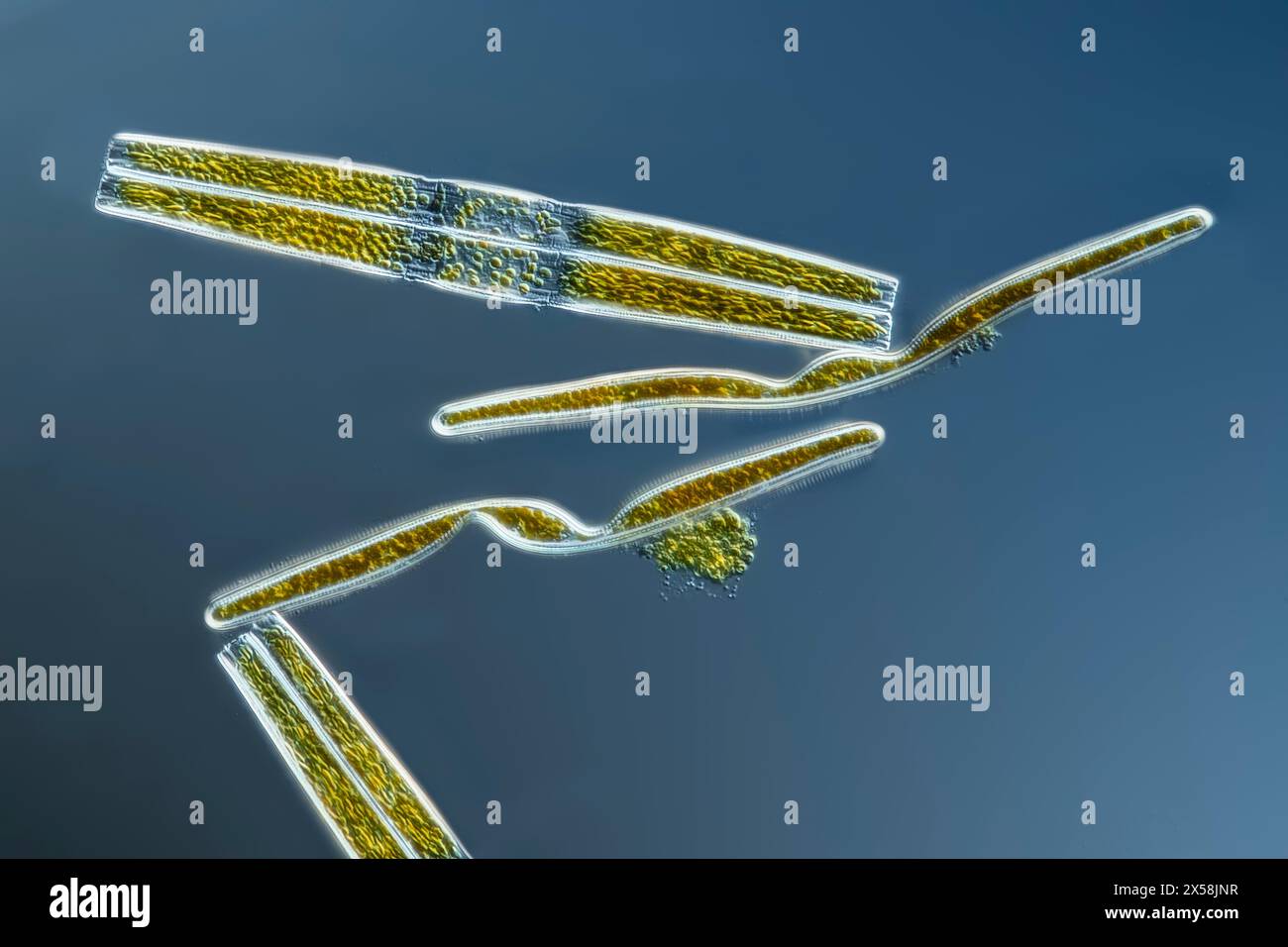 Differential interference contrast (DIC) light micrograph of Toxarium ...