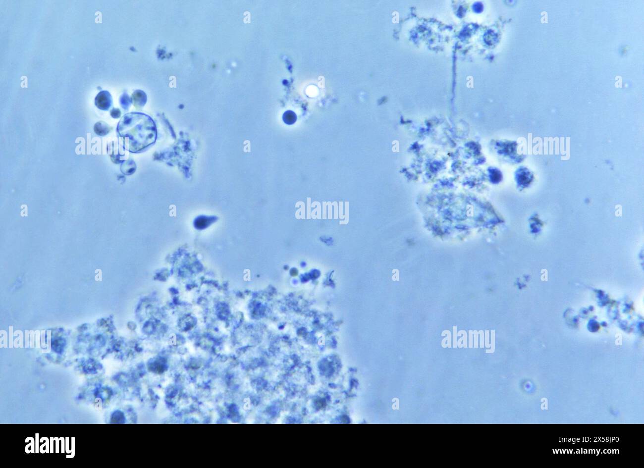 Stained light micrograph showing pathogenic fungi (Paracoccidioides sp ...