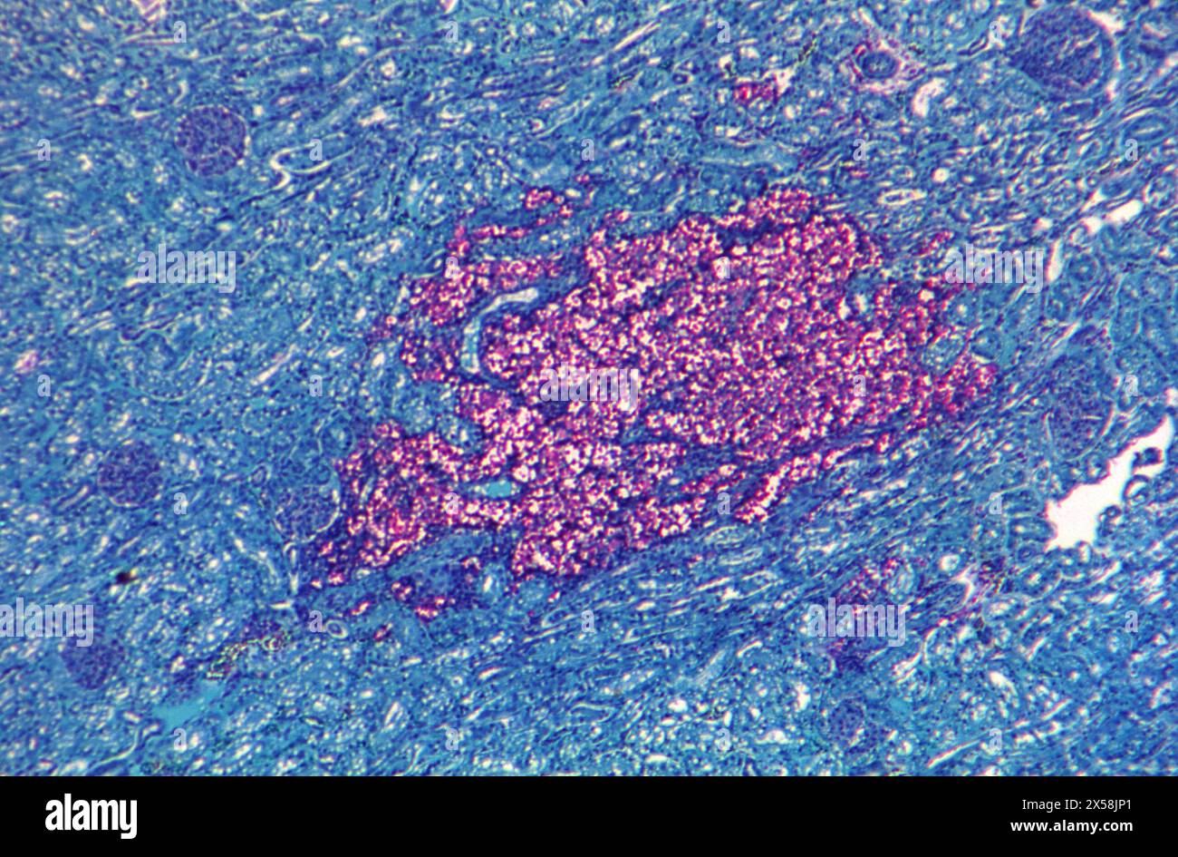 Light micrograph of a cat's kidney tissue stained with mucicarmine ...