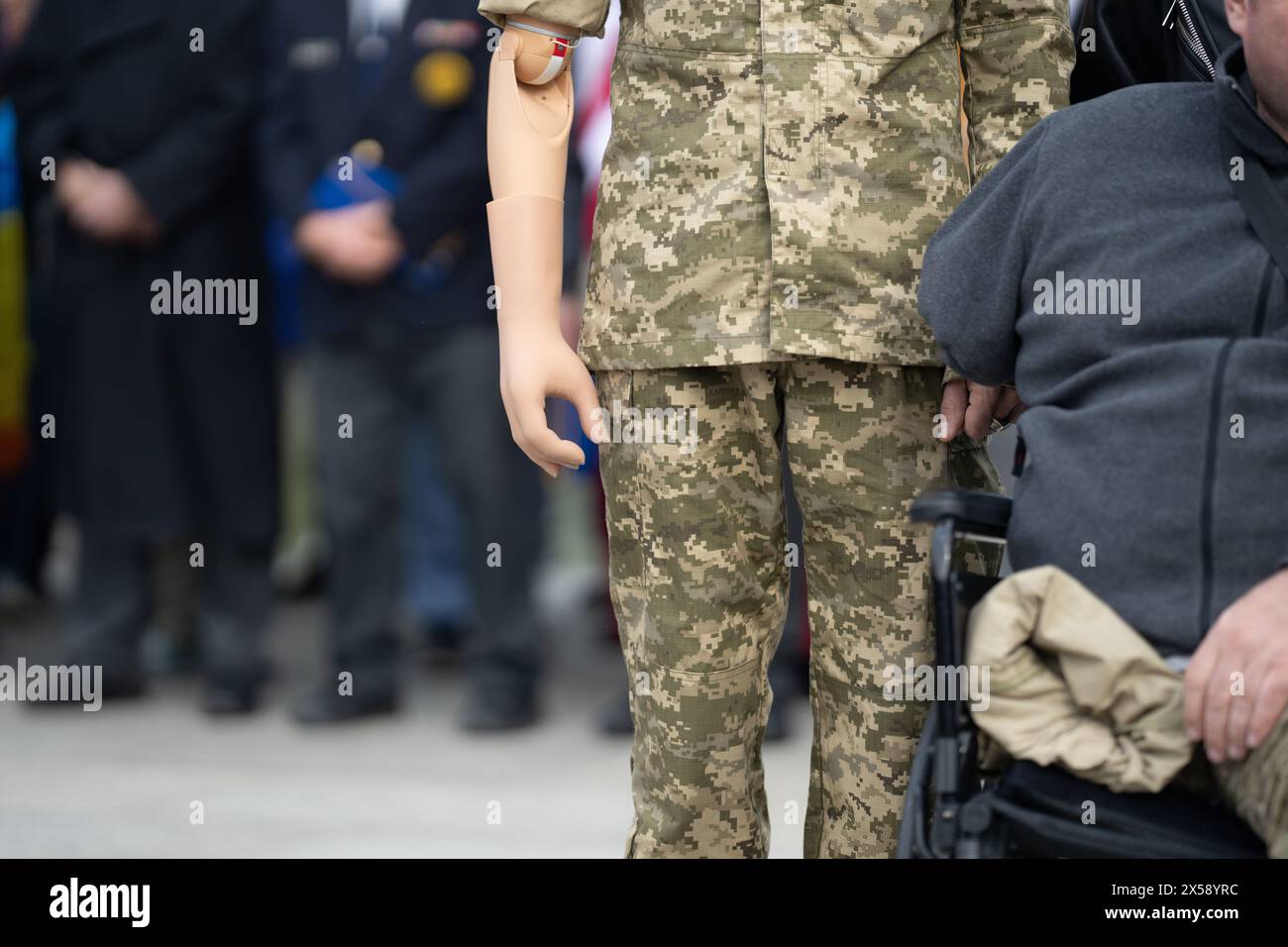 Ukrainian veteran soldier with amputation. War in Ukraine. Military ...