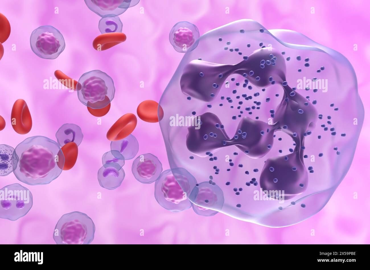 Hypersegmented neutrophil in WHIM Syndrome - Closeup view 3d ...