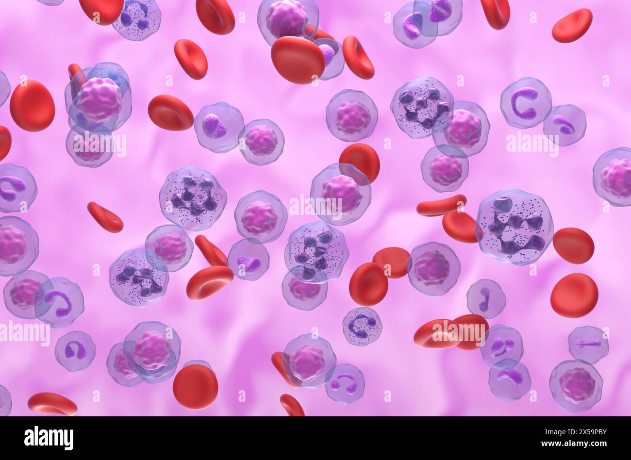 Hypersegmented neutrophil in WHIM Syndrome - isometric view 3d ...