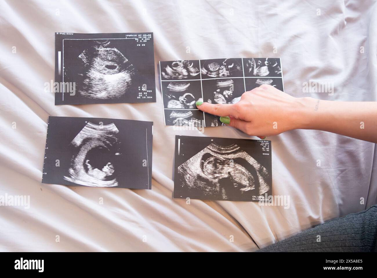 A pregnant woman hand pointing at ultrasound prints of her unborn baby ...