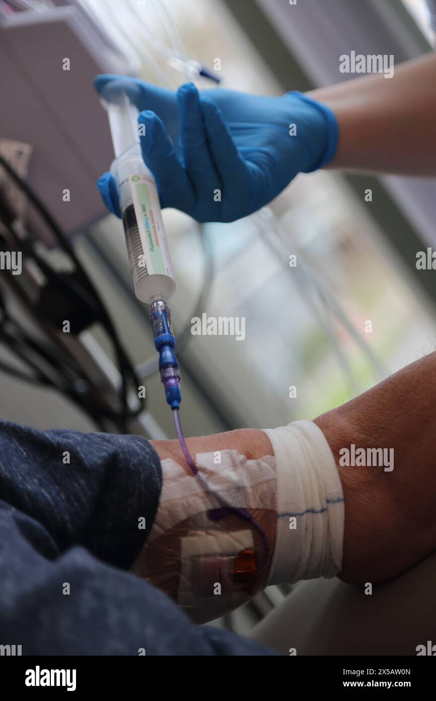 Chemotherapy drug Fluorouracil being Injected into Picc Line of Male ...
