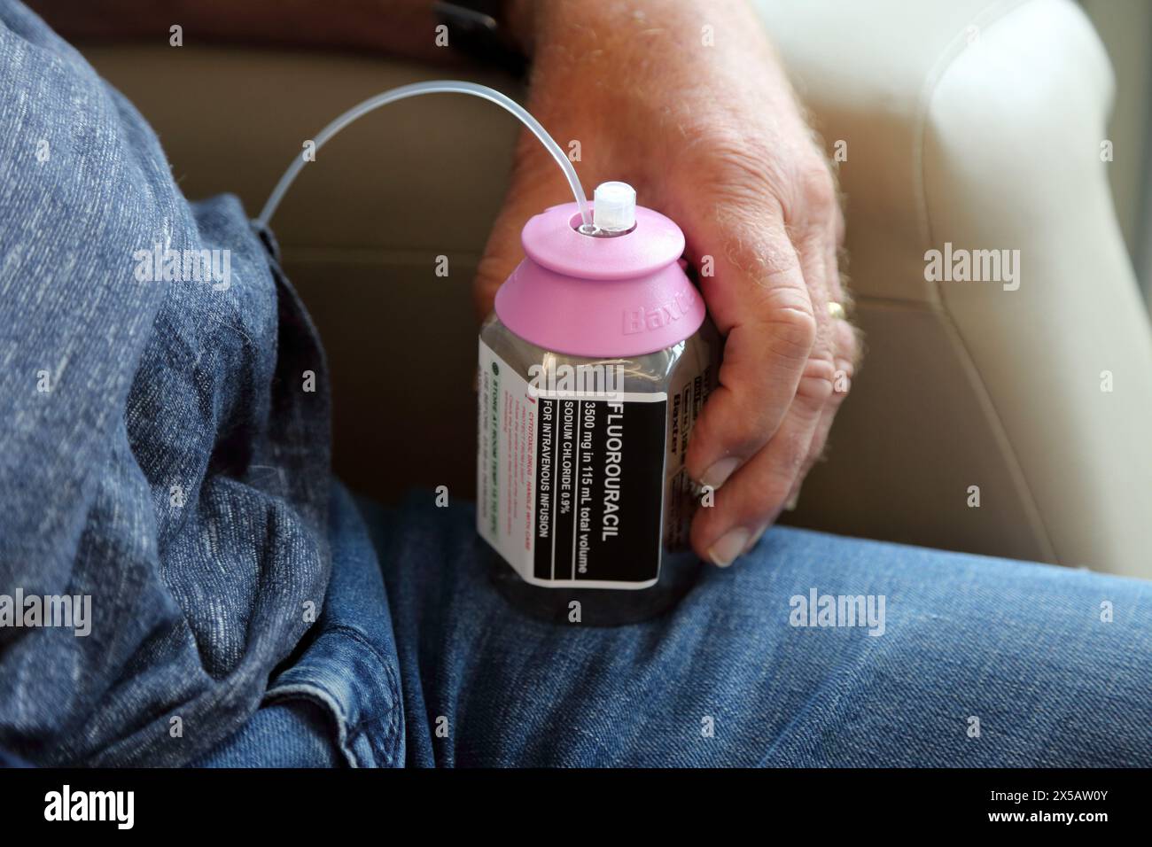 Man being Treated with Sodium Chloride Fluorouracil Cytotoxic Drug for ...