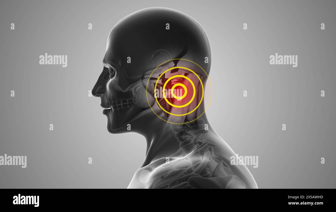 Mastoiditis hi-res stock photography and images - Alamy