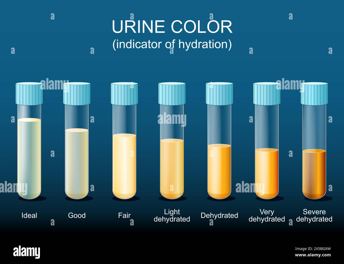 Urine color. Indicator of hydration. Laboratory test tubes with urine ...
