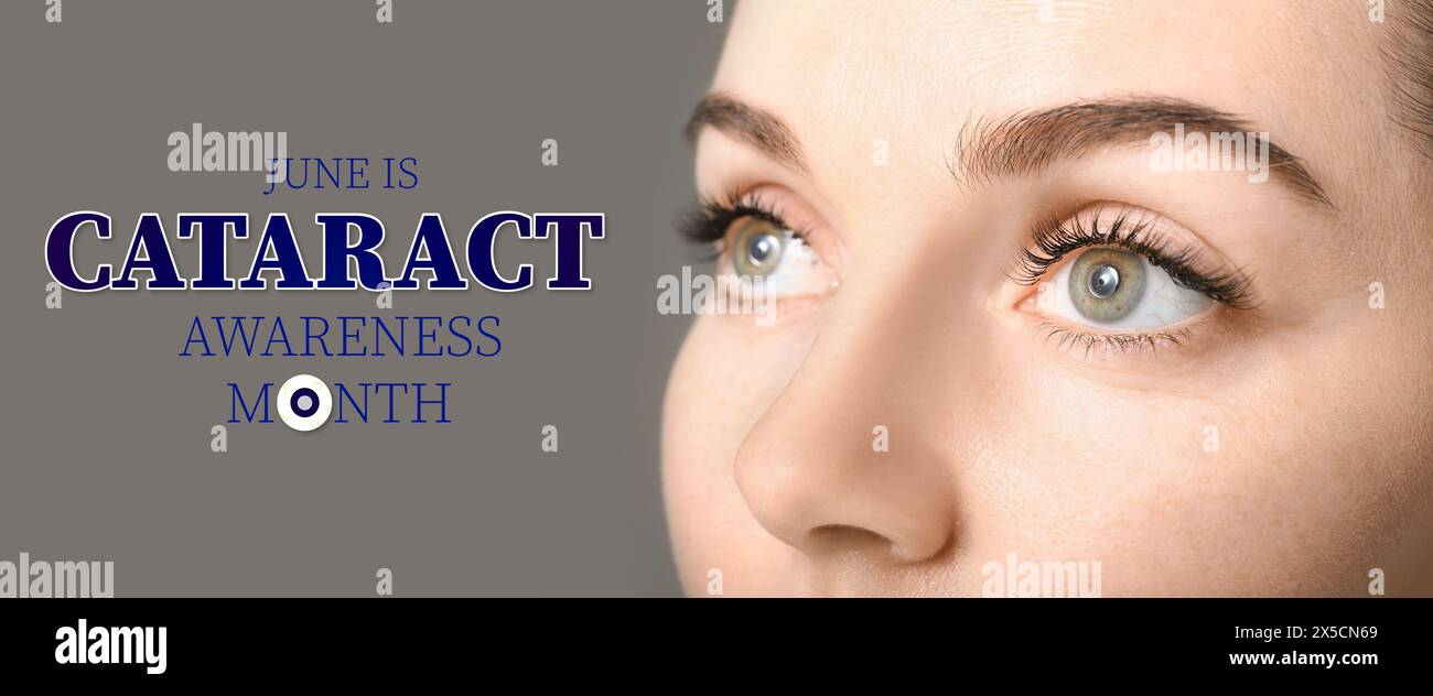 Eyes of beautiful young woman, closeup. Banner for Cataract Awareness ...