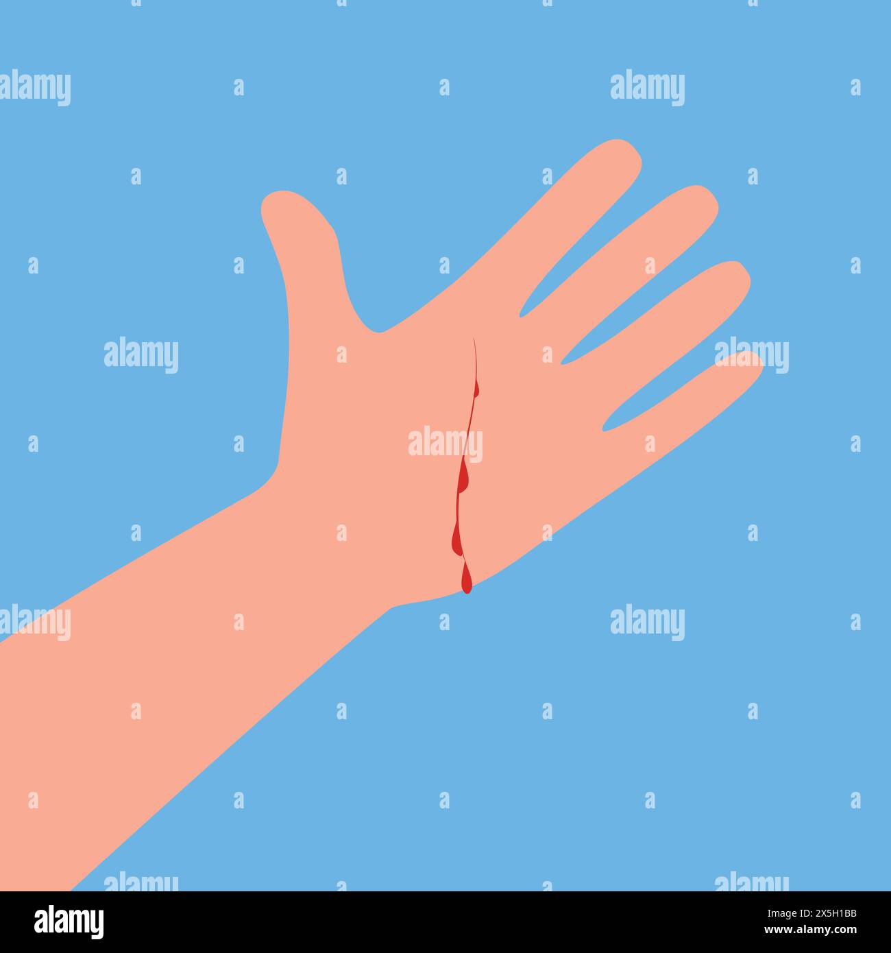 Wound on the hand palm. Red blood, infection in the cut. Skin injury ...