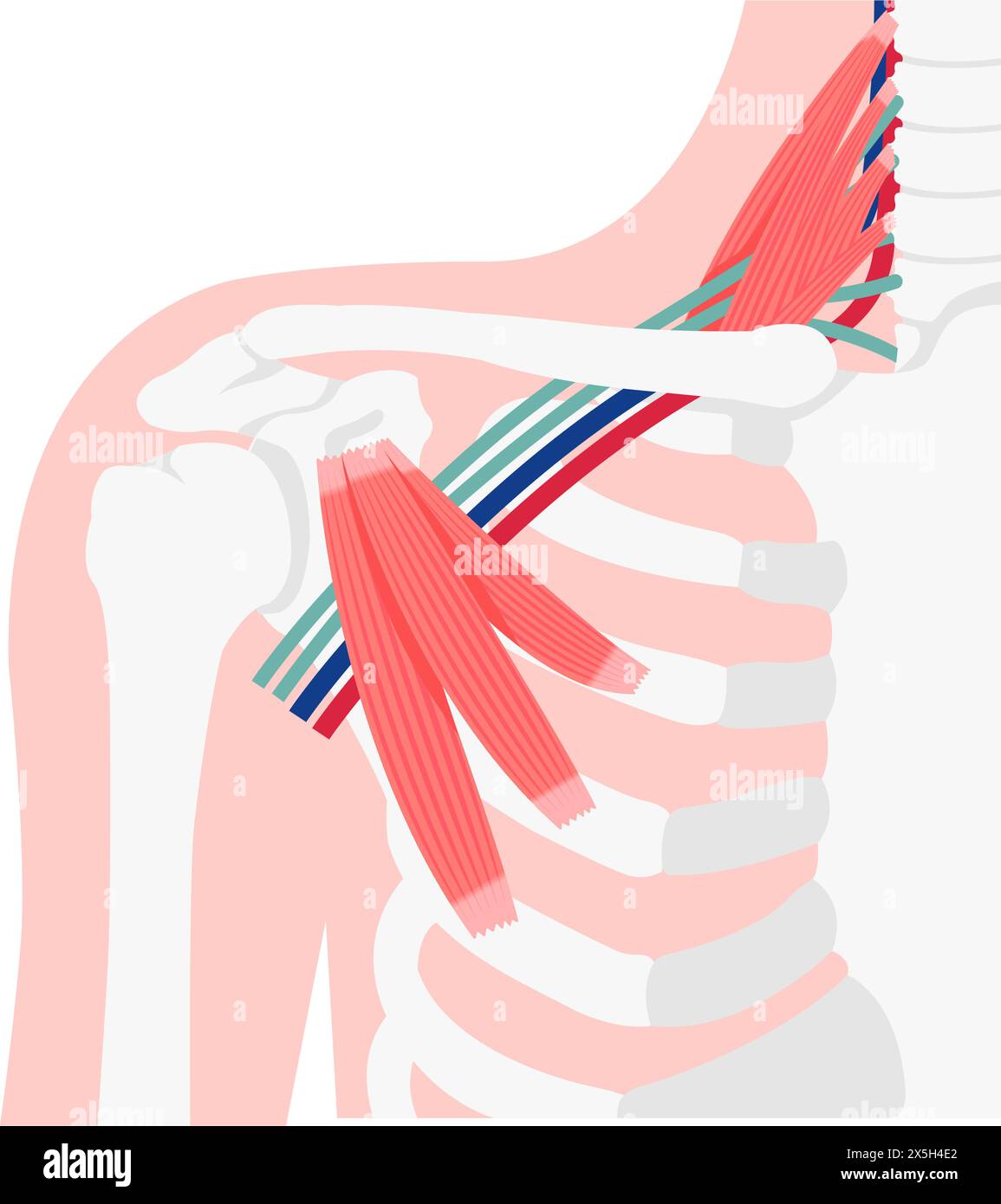 Vector illustration of where thoracic outlet syndrome occurs Stock ...