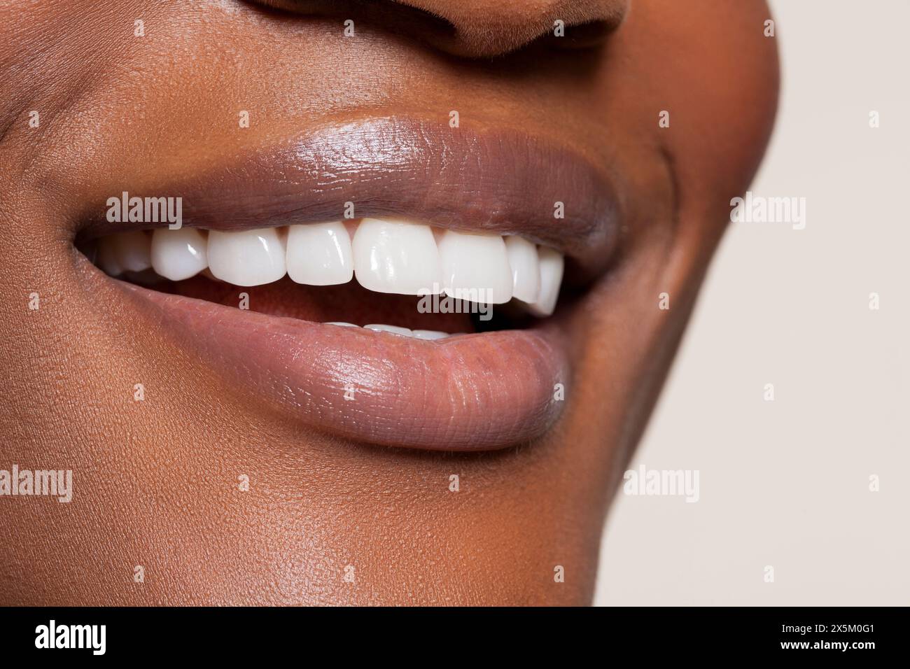 Toothy smile teeth hi-res stock photography and images - Alamy