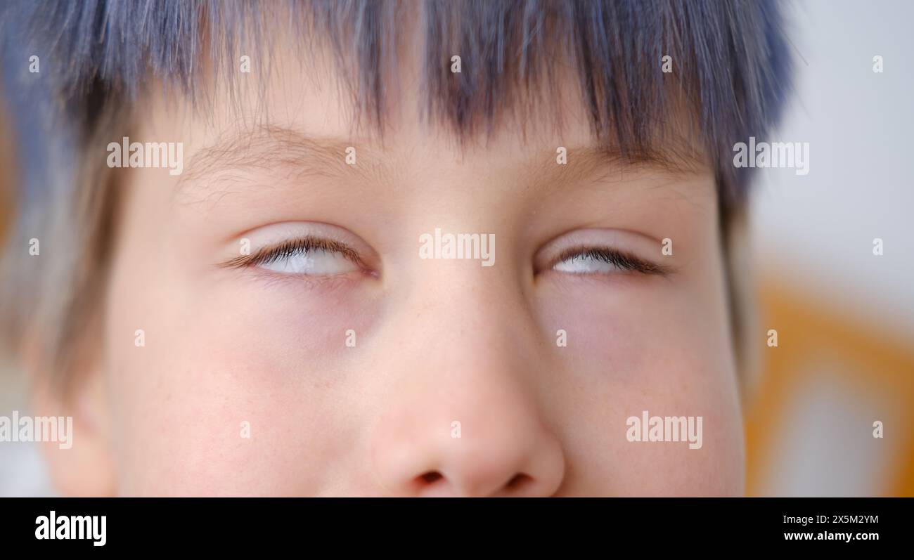 rolled eyes, close up part child face, boy 8 years old, human eye ...