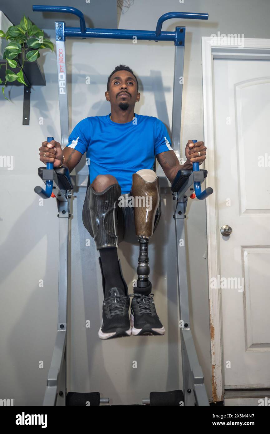 Man with prosthetic leg exercising at home Stock Photo - Alamy