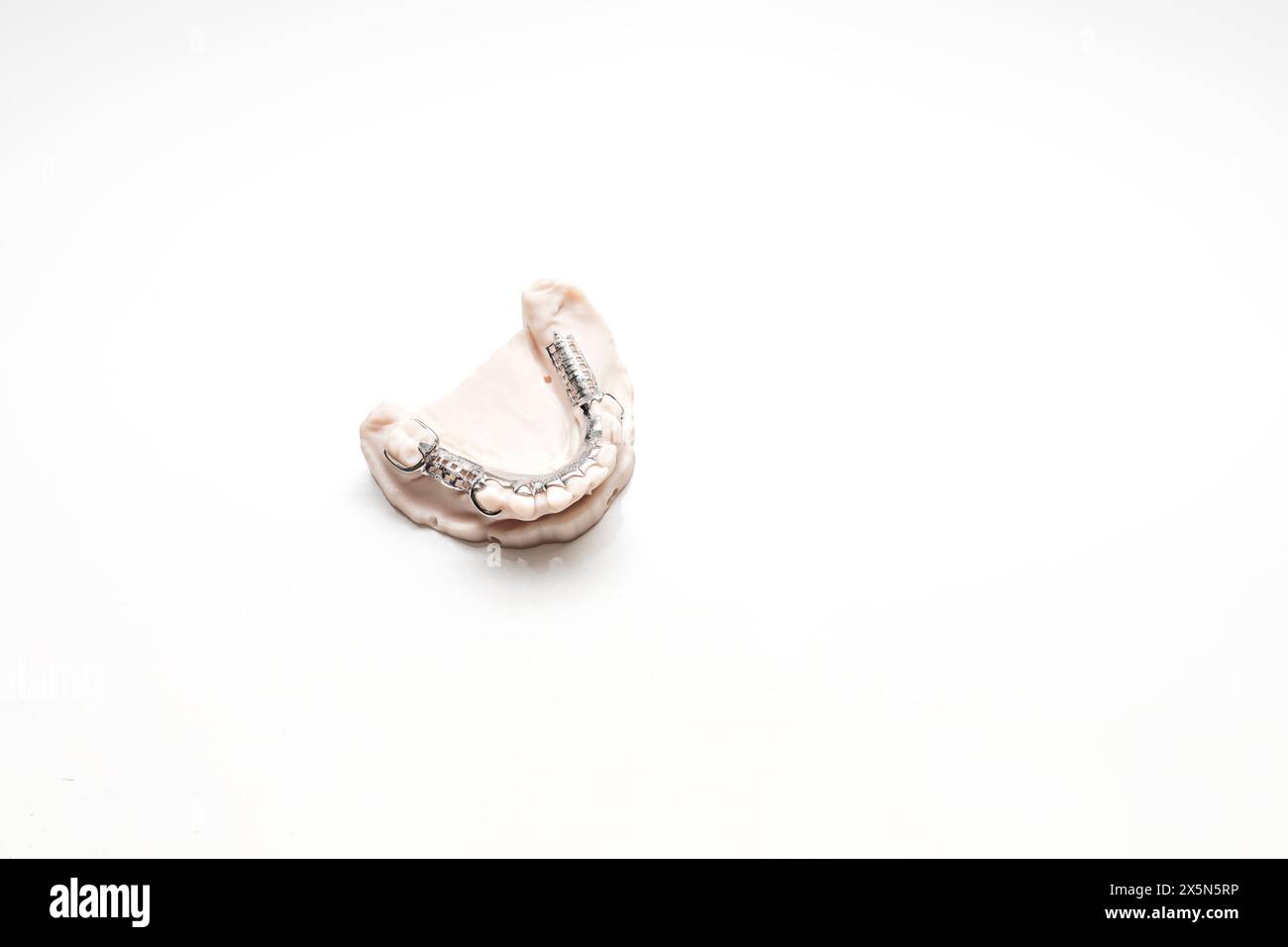 Isolated Metal Frame Lower Partial Denture On Die Stone, Plaster Cast ...