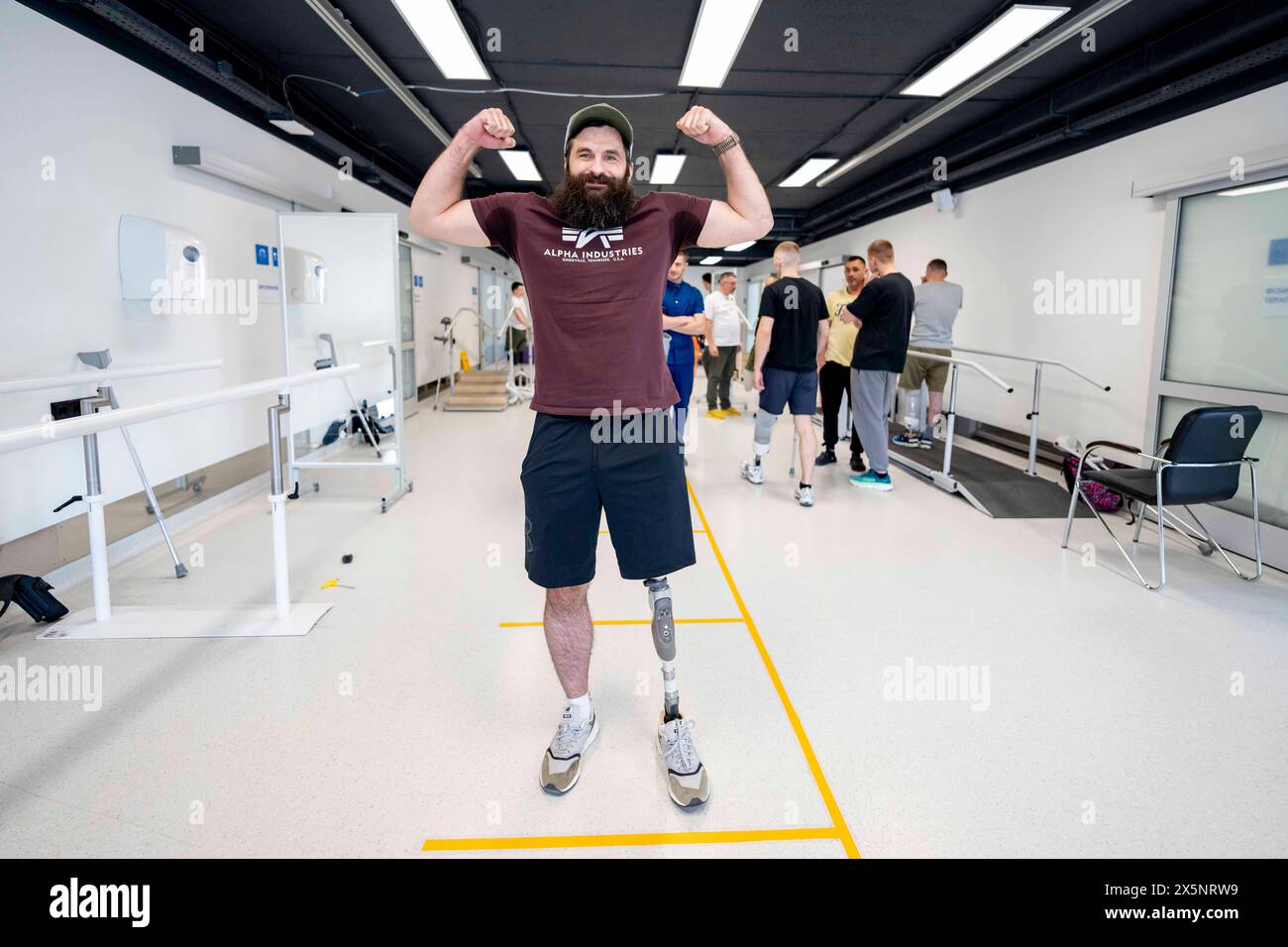 Man posing happily with his prosthetic leg at the Superhumans Center in ...